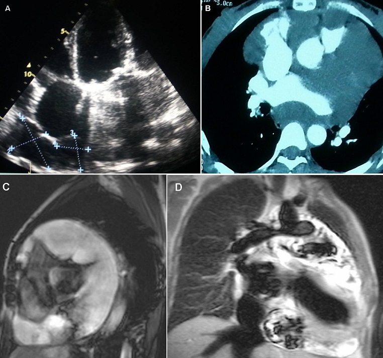 Hanane Hadj kacem, Zakaria Bazid