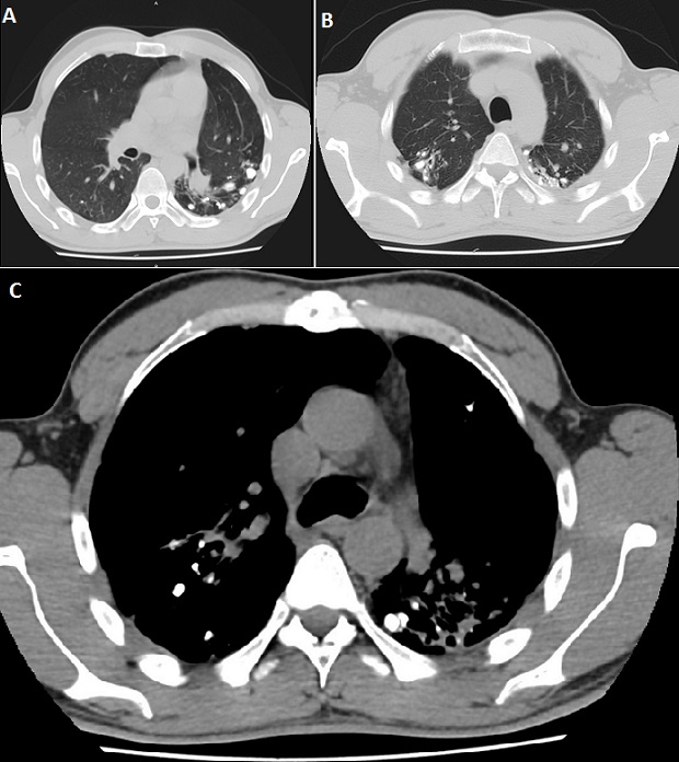 Nabil Hammoune, Hicham Janah