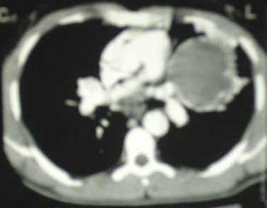 Madiha Mahfoudhi, Sami Turki