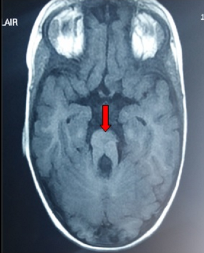 Mouna Sghir, Wassia Kesomtini