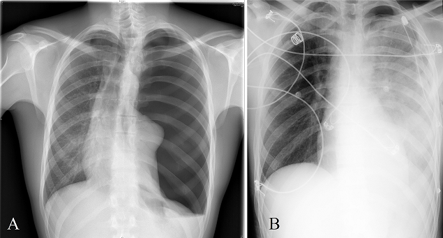 Adriá Rosat, Carmen Díaz