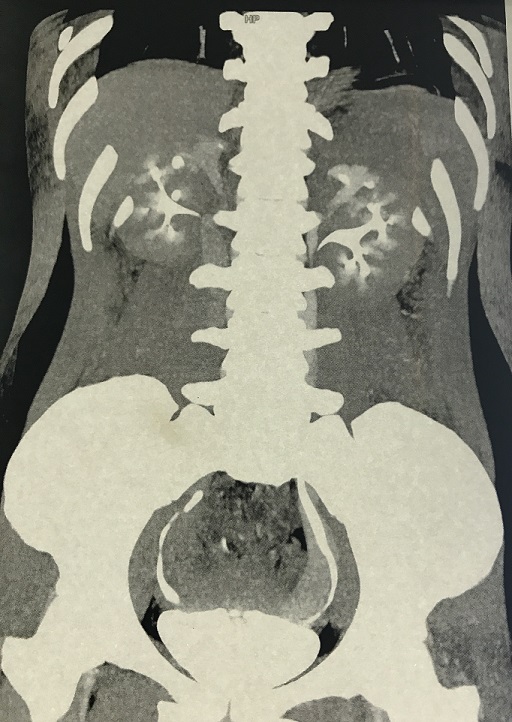Souhail Regragui, Amine Slaoui