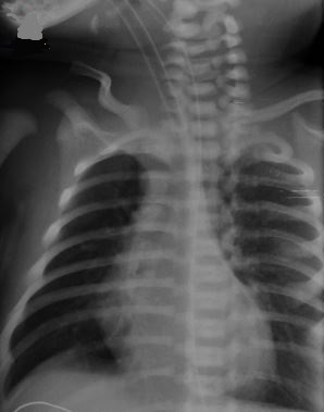 Transposition Egg On A String