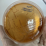 A young child with acute perforated appendicitis due to Comamonas ...