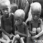 Factors associated with childhood chronic malnutrition in West and ...