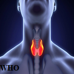 Cytokeratin 19 (CK19) expression by thyroid neoplasms in a Nigerian ...