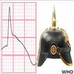 The spiked helmet sign in a patient with erysipelas: an alarming ...