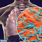 Predictors of tuberculosis treatment outcome at Senkatana clinic in Lesotho